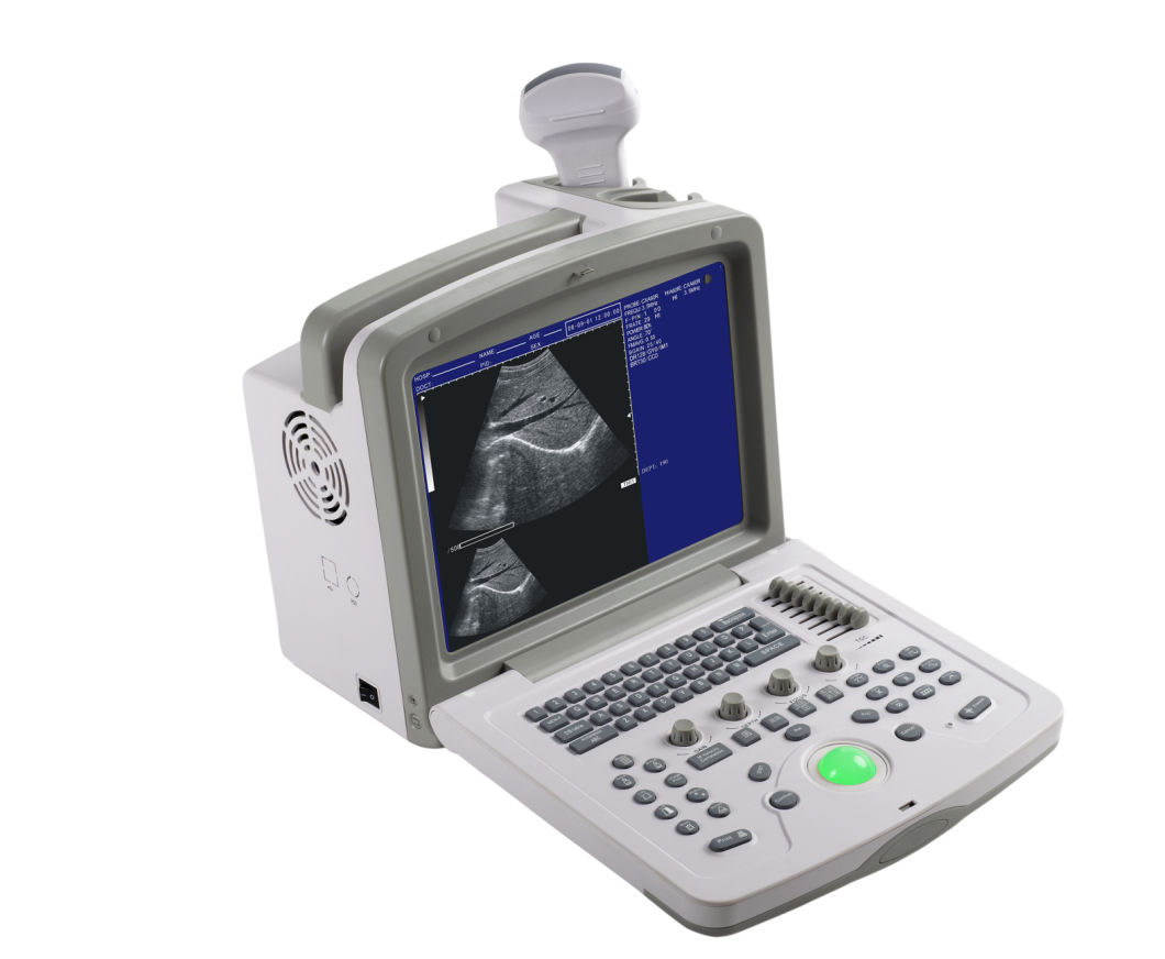(MS-9000AB) Laptop Portable Fully Digital Ultrasound Scanner Black and ...